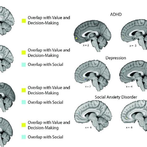 Functionally Specialized Subregions Of The Ventromedial Prefrontal Download Scientific Diagram
