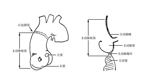 图9 1 主动脉根部的组成 心脏外科基础图解 医学