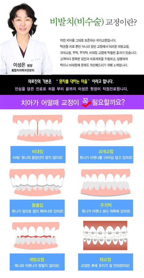 치아교정 이벤트 모두닥
