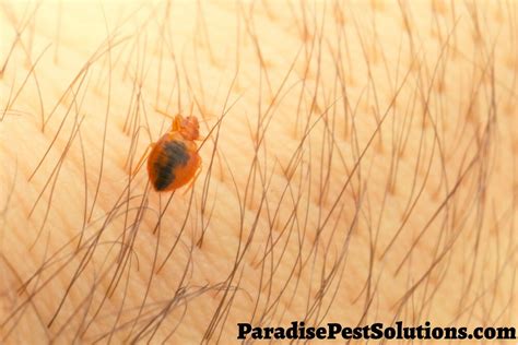 Can Bed Bugs Live In Your Hair