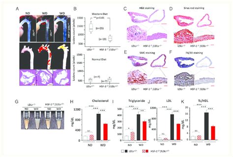 Attenuation Of Atherosclerotic Lesion And Improved Lipid Profile In