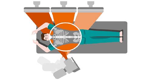 Radiography Systems Siemens Healthineers
