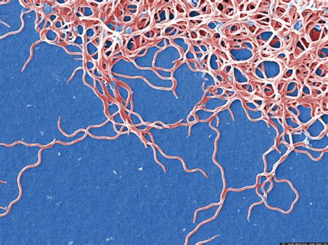 Lyme Disease Bacterium Switches Out Iron For Manganese To Evade Immune