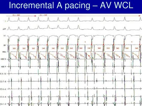 ppt pr inciples of e p his bundle mapping techniques powerpoint presentation id 4978187