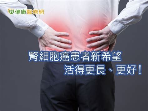 腎臟癌發生人數增3倍 免疫療法提供治療新契機uho優活健康網