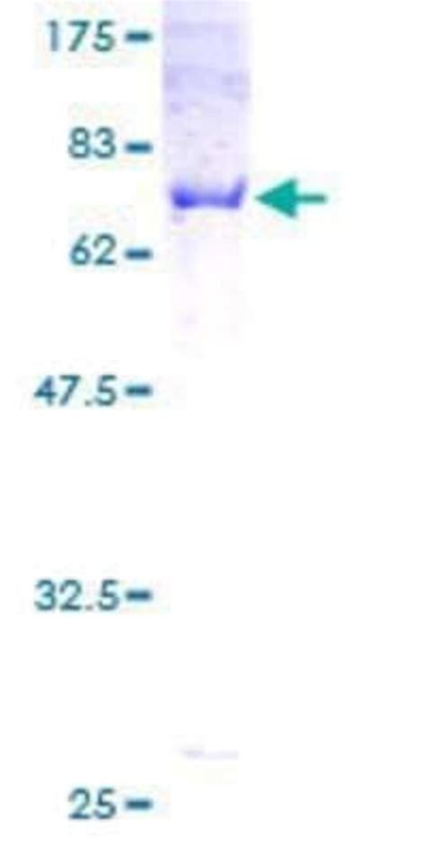 Novus Biologicals™ Recombinant Human Cnpase Gst N Term Protein 10 μg