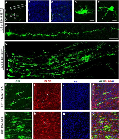 Lineage Tracing Of Astrocyte Migration In The Developing Diencephalon