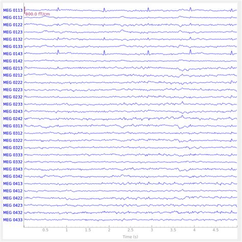 Overview Of Megeeg Analysis With Mne Python — Mne 1100dev138