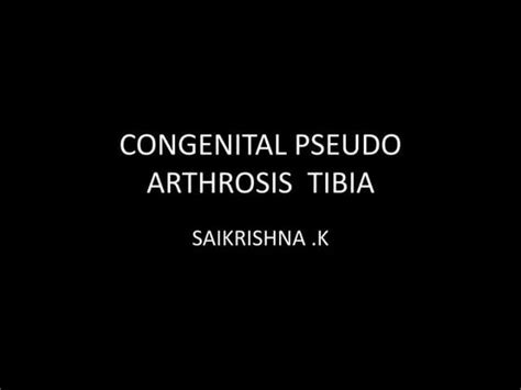Congenital Pseudoarthrosis Of Tibia Ppt
