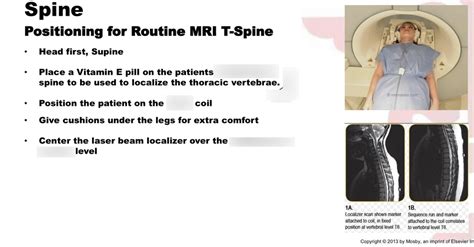 Amri 101 Slice Angulation T Spine Diagram Quizlet