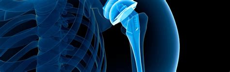 Subacromial Decompression Surgery Dr Raman Kant Aggarwal