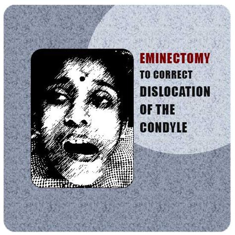 Eminectomy To Correct Dislocation Of The Condyle Richardson Dental