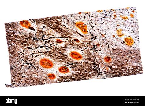 Epithelium Simple Squamous Photomicrograph X75 At 10 Cm Wide Stock