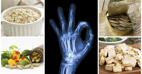 Los Mejores Alimentos Para Proteger Y Fortalecer Tus Huesos