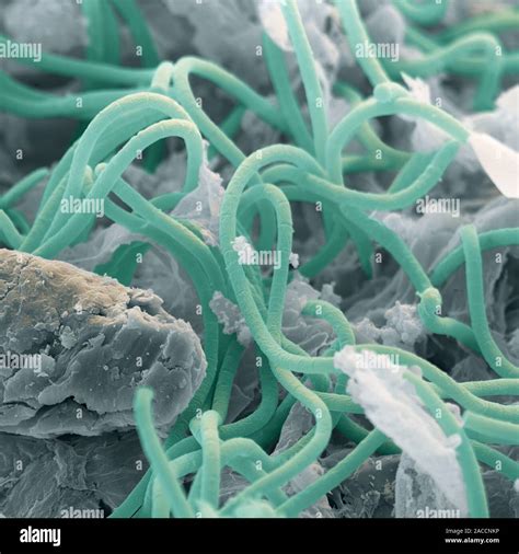 Microbial Sphere Coloured Scanning Electron Micrograph Sem Close Up Of Filaments Green Of