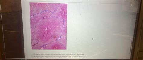 Solved Hexagonal Plates Of Hepatocytes Surrounding A Central