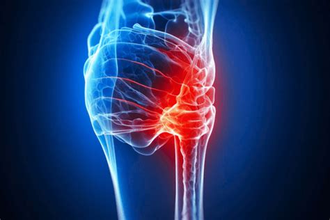 Bone Cancer Treatment Medicstreet