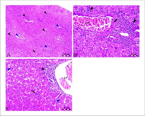 A Photomicrographs Of The Liver Of Hcc Induced Group Showing Loss Of