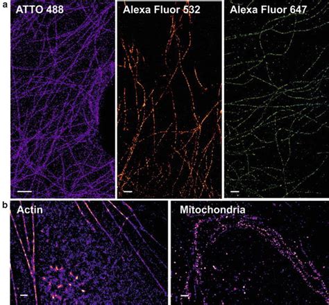 Direct Stochastic Optical Reconstruction Microscopy Dstorm