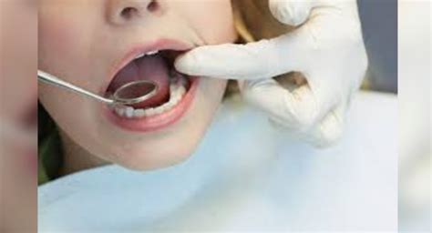 මුඛ පිළිකා රෝගීන් සංඛ්‍යාව 9 ගුණයකින් ඉහළට Sri Lanka News