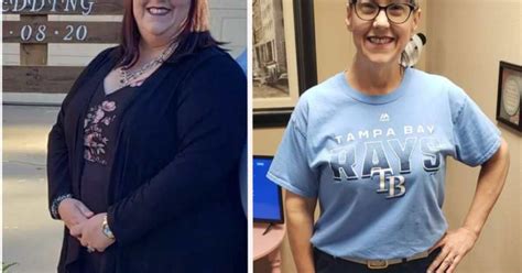 Mounjaro Weight Loss Before And After Incredible Secrets