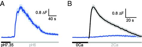 Transformed Granule Cells Lack CaSR Mediated Inhibition Of