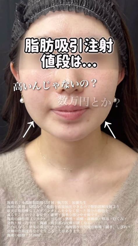 【公式】湘南美容外科クリニックさんのインスタグラム動画 【公式】湘南美容外科クリニックinstagram 「ご予約はプロフィールから