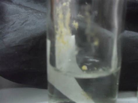 Colony Of Trichoderma Sp On Filter Paper Strip Immersed In Sea Water