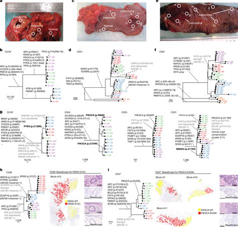 Spatial Phylogenomics Of Colorectal Cancer A In This Msi Tumour C516
