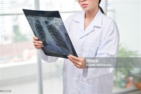 리브 케이지 X레이를 정확 하 게 검사 하는 자신감 있는 여성 의사 X 레이에 대한 스톡 사진 및 기타 이미지 X 레이