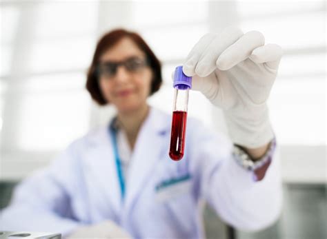Basophils Biomarker Test Guide Lab Tests App