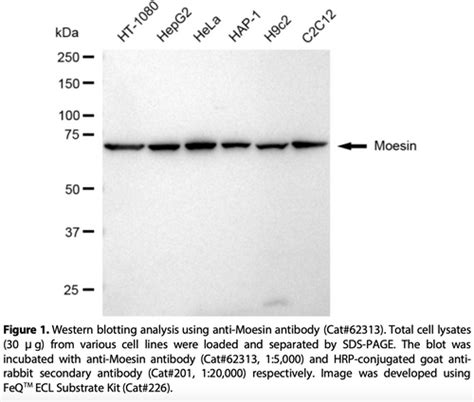 KD Validated Anti Moesin Rabbit Monoclonal Ab GenuIN Biotech