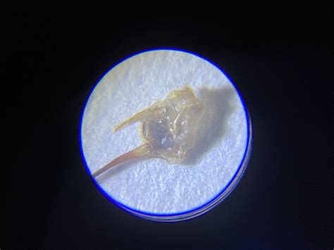 Can You Identify The Bug From The Stinger R Bugidentification
