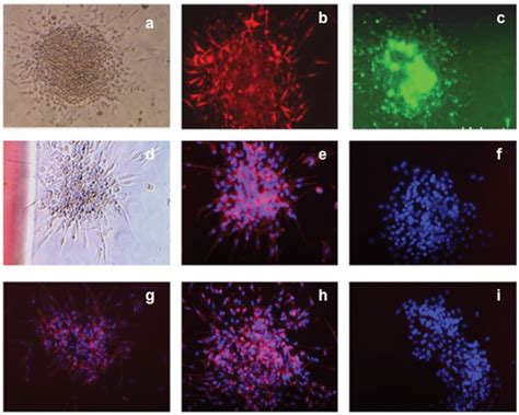 Characteristics Of Colony Forming Units Cfus In Culture Derived From