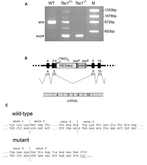 Figure 2 From A Mouse Model Of Tuberous Sclerosis 1 Showing Background