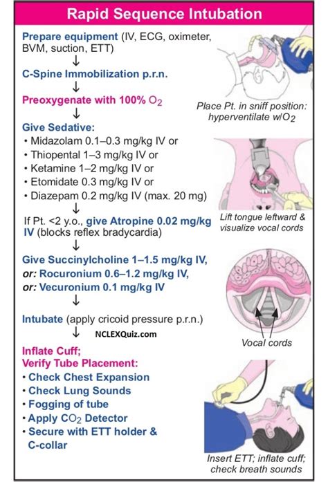 Rapid Sequence Intubation Guidelines 2013 Musicalhoure