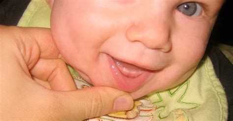 Tryitmom Wordless Wednesday Teeth