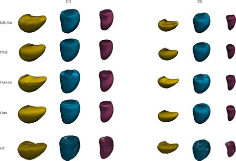 figure 3 from neural deformable models for 3d bi ventricular heart