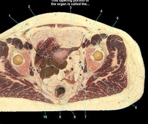 Cross Sectional Female Diagram Quizlet