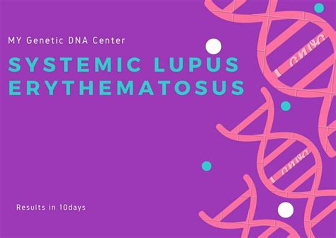 Systemic Lupus Erythematosus My Genetic Dna Center