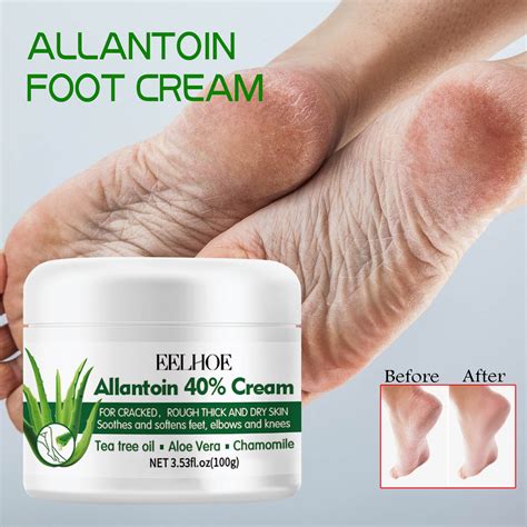 Betivan 40 Urea Cream With 2 Salicylic Acid Foot Cream With Aloe