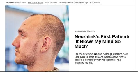 As Seen In Barrow Neurological Institute