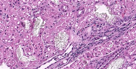 Ethylene Glycol Crystals Pdb 1lg2 Structure Summary ‹ Protein Data