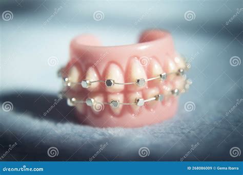 Metal Orthodontic Denture Base Stock Image Image Of Oral Background 268086009