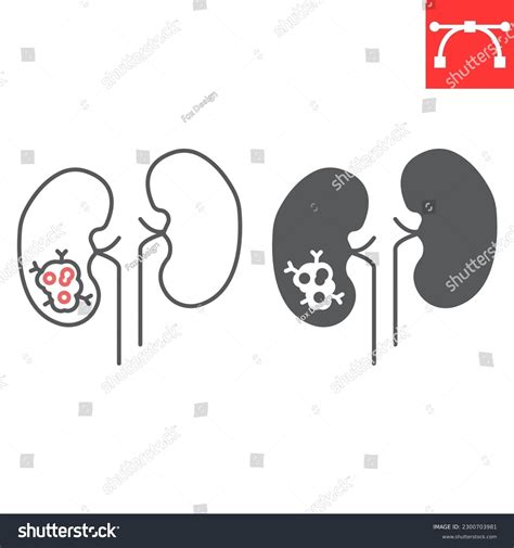 4 Solid Tumor In The Kidneys Images Stock Photos Vectors Shutterstock