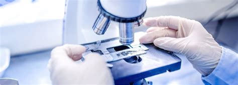 آزمایش Hpv در مردان تست ویروس اچ پی وی مردان