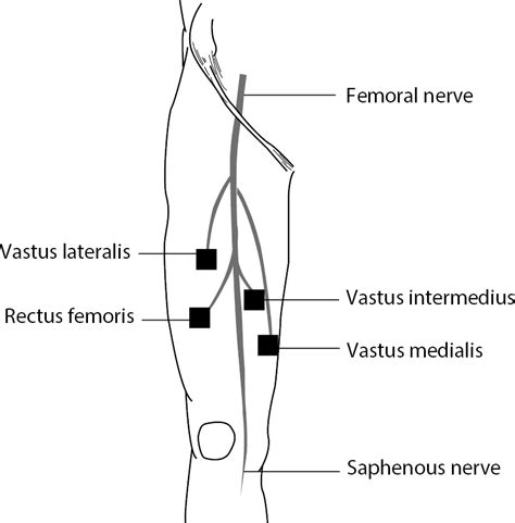 Femoral Nerve