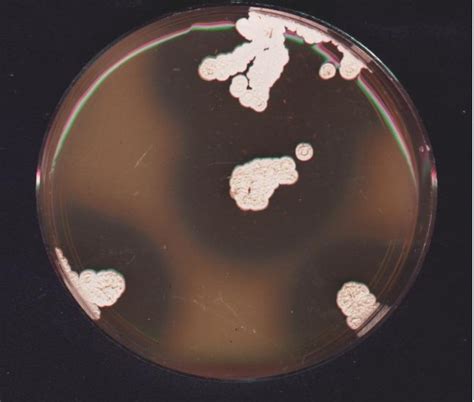 Figure 1 From Optimization Of Alkaline Protease Production By Streptomyces Sp Strain Isolated
