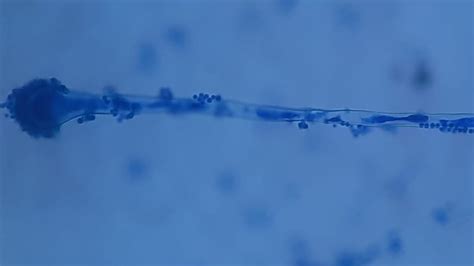 Aspergillus Niger Vs Aspergillus Fumigatus Introduction Differences