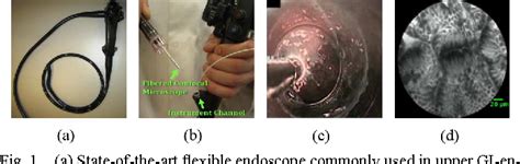 Figure 1 From Endoscopic Video Manifolds For Targeted Optical Biopsy